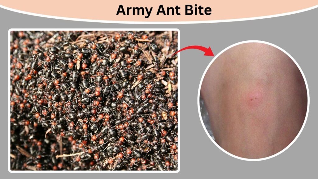 25 Types Of Insects Bites: Identification, Symptom with Pictures
