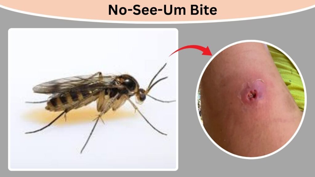 25 Types Of Insects Bites: Identification, Symptom with Pictures