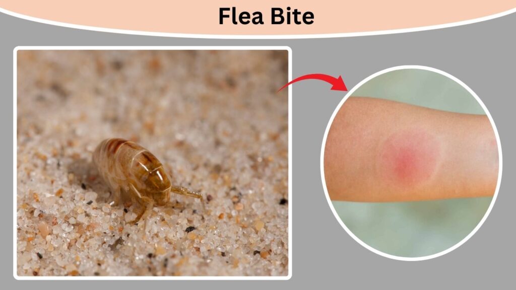 25 Types Of Insects Bites: Identification, Symptom with Pictures