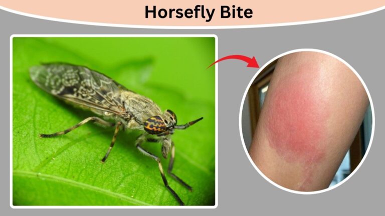 25 Types Of Insects Bites: Identification, Symptom with Pictures