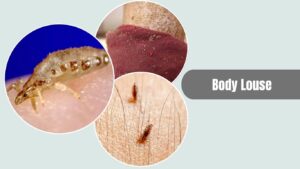 17 Types of Lice: Species That Affect Humans, Animals & Birds
