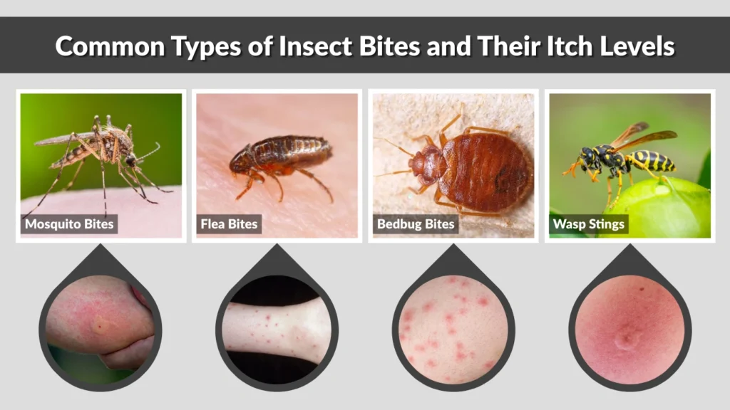 How Do You Stop Insect Bites from Itching