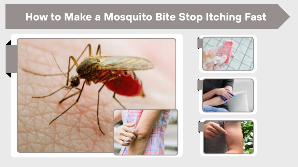 How to Make Mosquito Bites Stop Itching Fast & Naturally