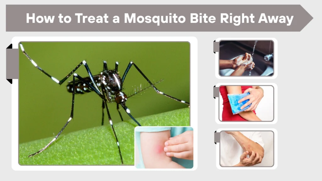 How to Treat Mosquito Bites Fast: Itching, Swelling & Allergy