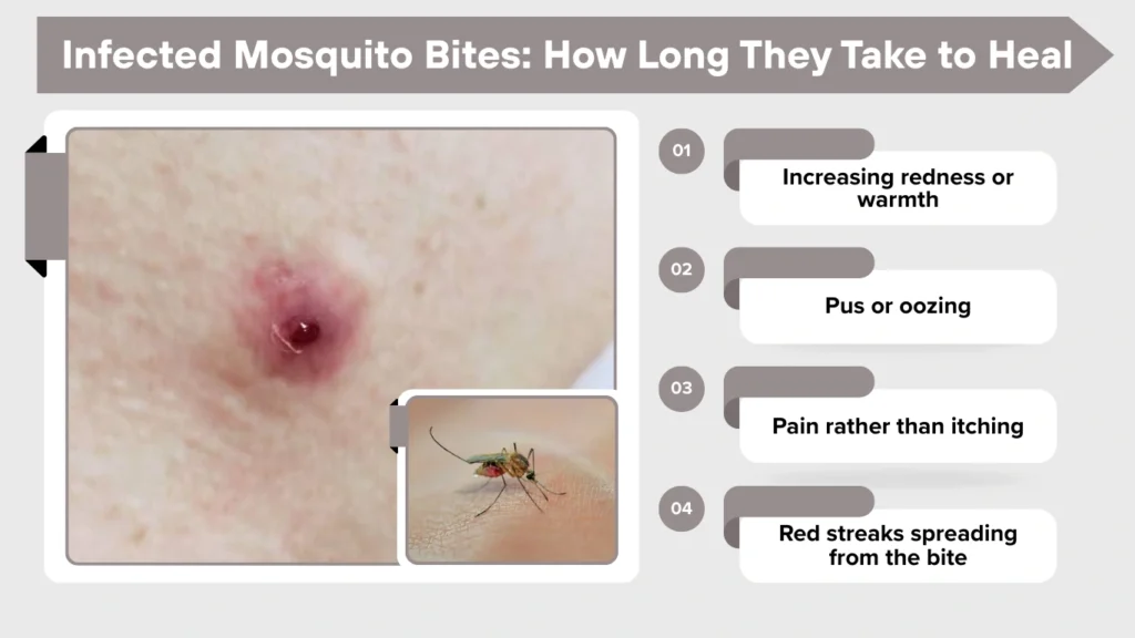 How Long Do Mosquito Bites Last? Healing, Itching & Marks