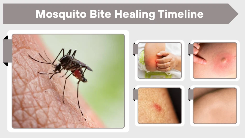 How Long Do Mosquito Bites Last? Healing, Itching & Marks