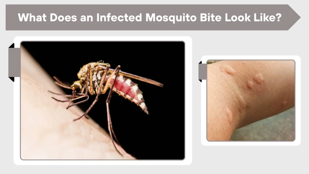 Infected Mosquito Bite: Symptoms, Pictures, Treatment & Cure