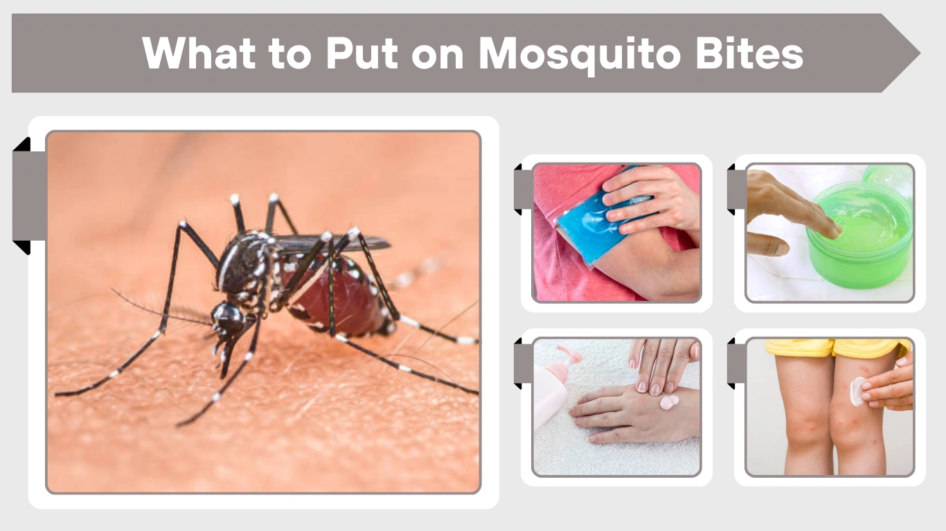 What to Put on Mosquito Bites to Stop Itching & Swelling
