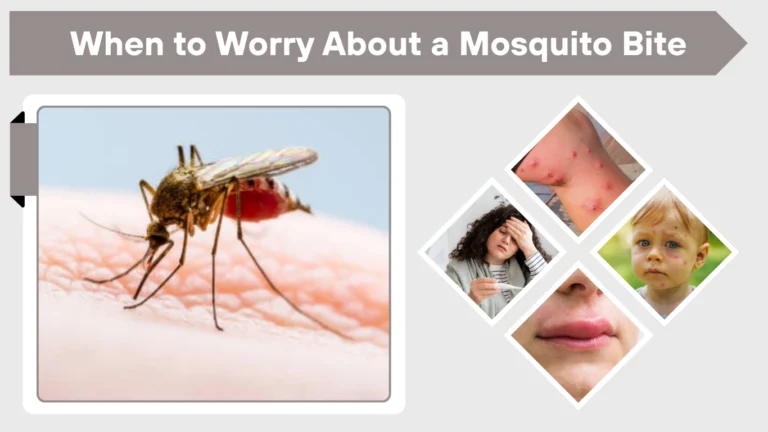 When to Worry About a Mosquito Bite: Signs You Shouldn’t Ignore