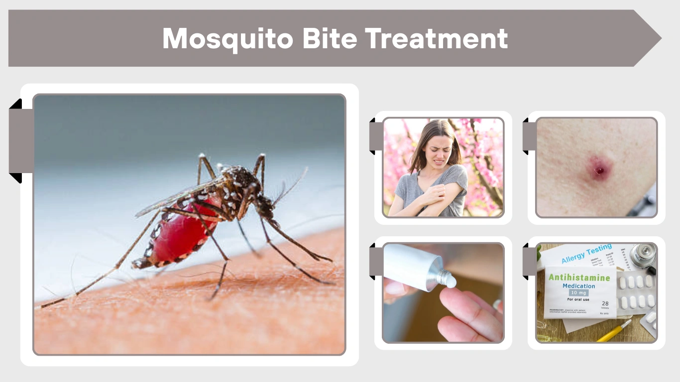Mosquito Bite Treatment: What Works for Swelling, and Infection