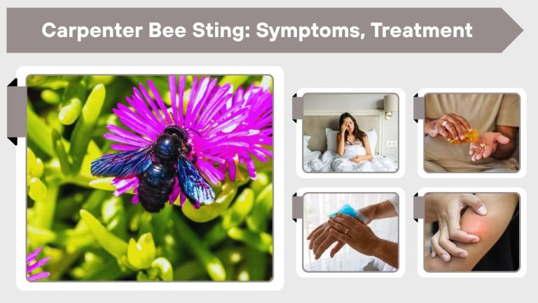 Carpenter Bee Sting: Symptoms, Treatment & Safety Guide